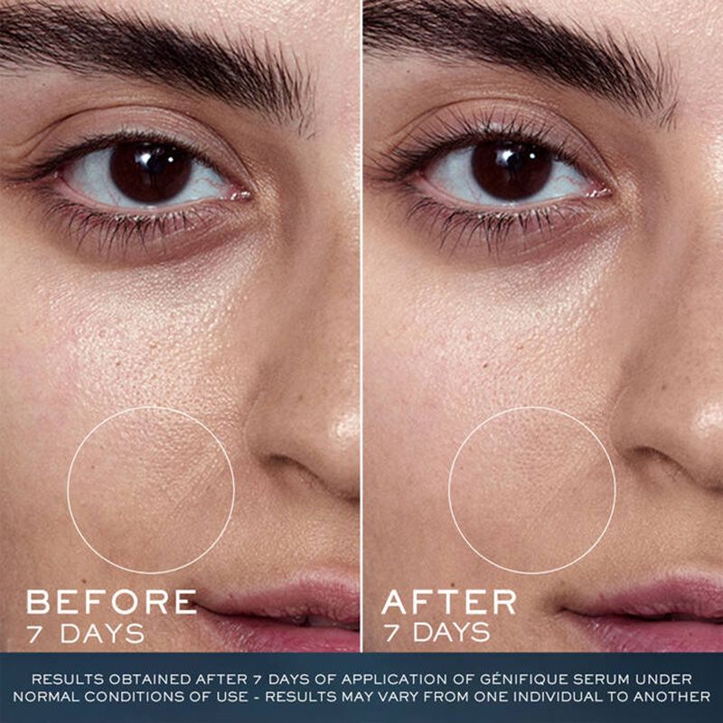 Lancome Advanced Genifique Face Serum - MeetIDEA